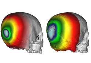 Did Hirota People in Japan Deliberately Deform Their Skulls? - Japan Daily